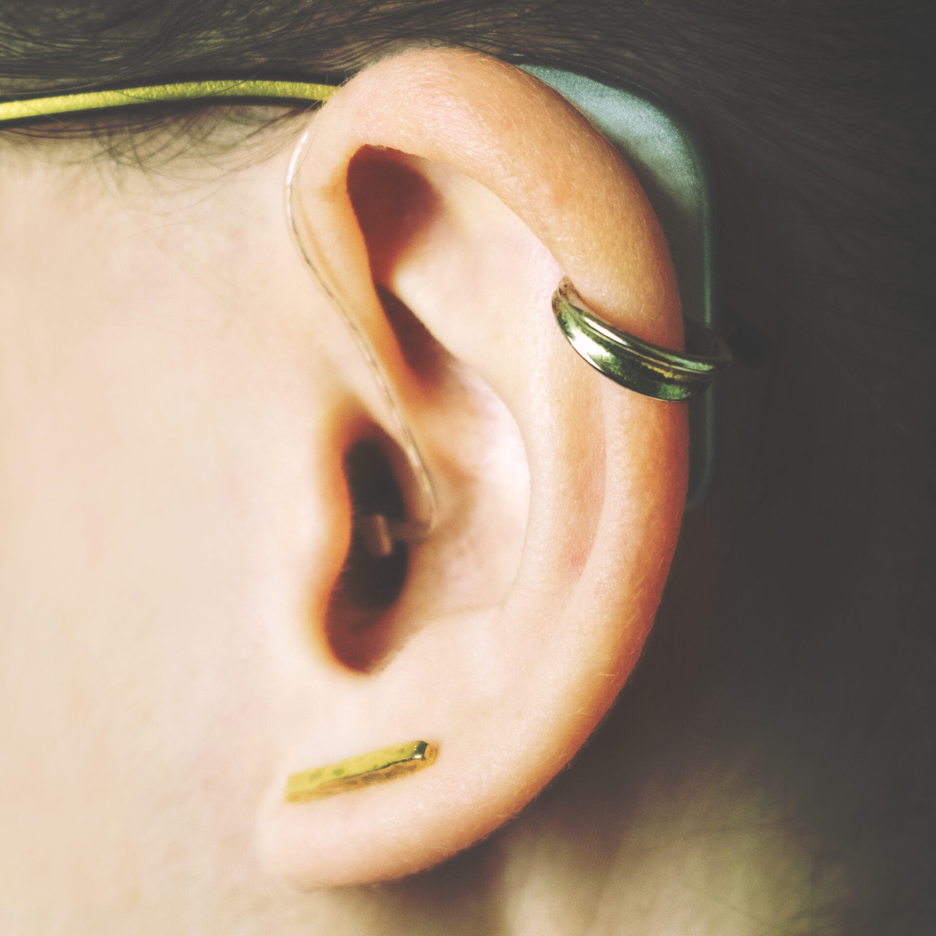 What is an OCT Scan? - Dipple & Conway